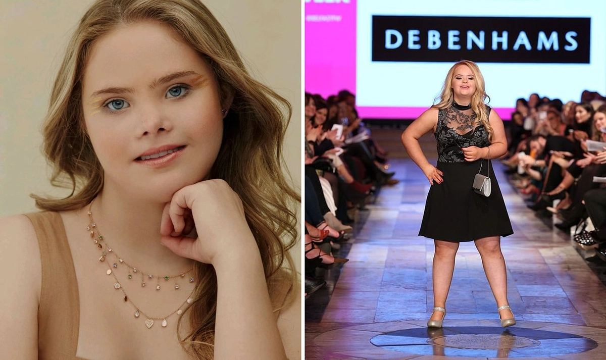 Модель с синдромом Дауна покорила модные подиумы
